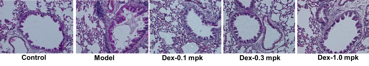 The OVA-induced Asthma Model in Mice and Rats: An Overview ...