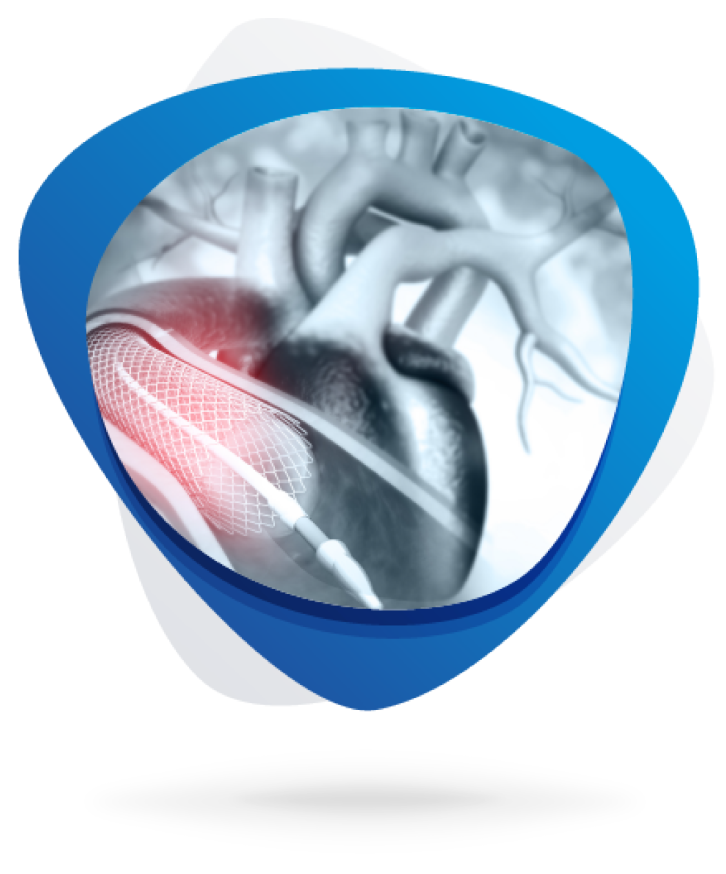 Cardiovascular CRO - PharmaLegacy | Preclinical Pharmacology CRO